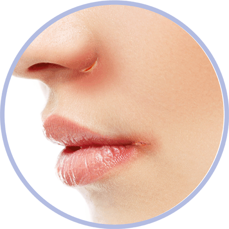 le ragadi – Rhagadil